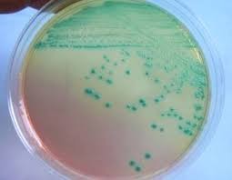 Kemiteks Kimyevi Maddeler Tic. ve Ltd. Şti. | Dehidre Kültür Besiyerleri | LABM | M17 Agar