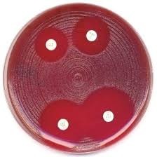 Kemiteks Kimyevi Maddeler Tic. ve Ltd. Şti. | 90 mm Petride, Tüpte ve ...